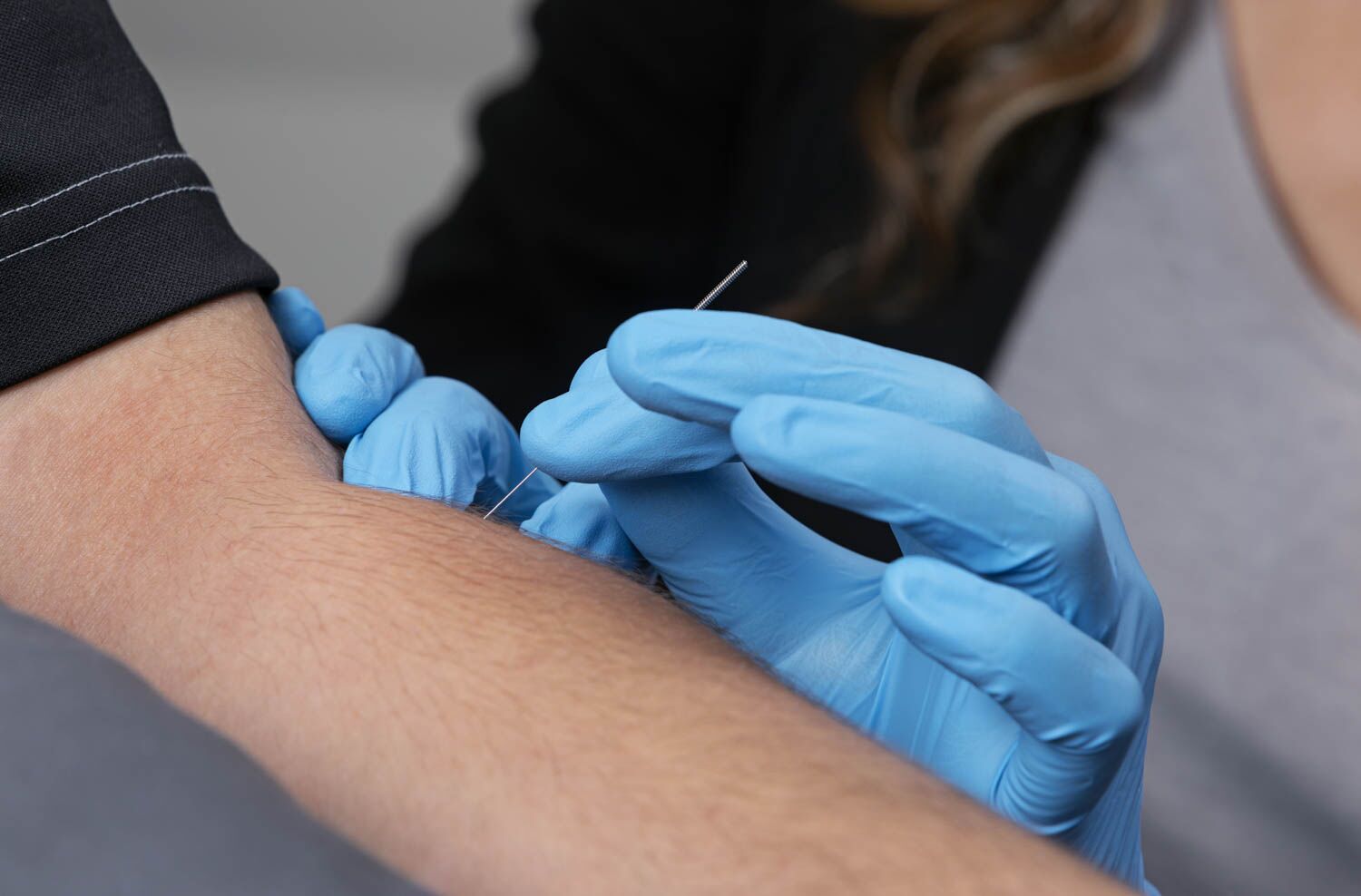 Dry Needling/IMS - The Joint Physiotherapy